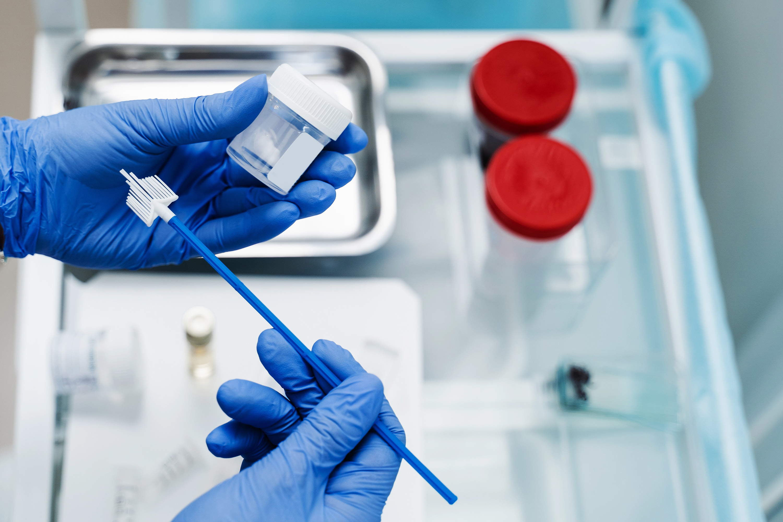 NHS urges Londoners to complete cancer screening checks | North East ...